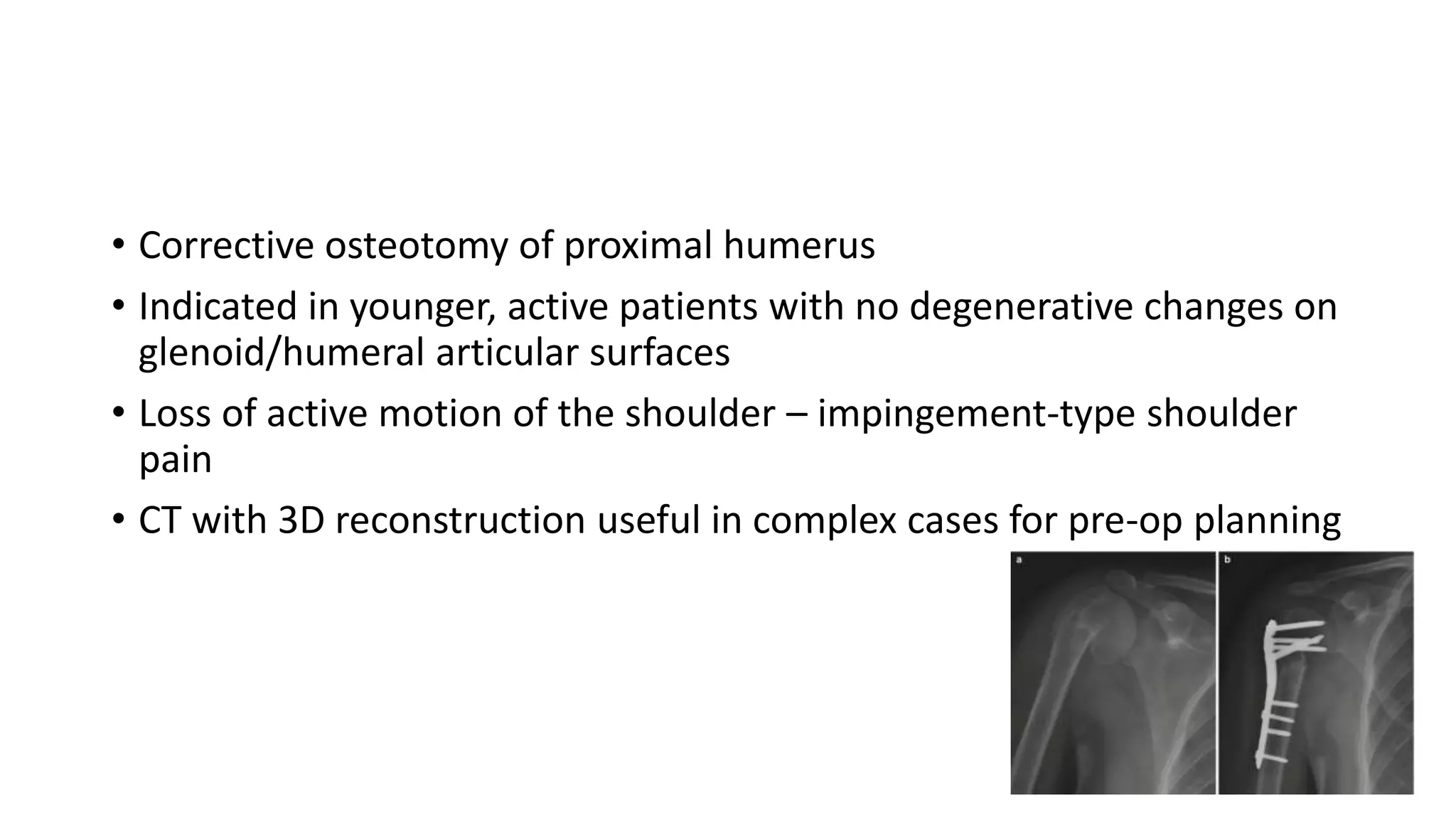 MANAGEMENT OF NONUNIONS AND MALUNIONS OF PROXIMAL HUMERAL FRACTURES.pptx