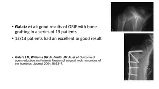 MANAGEMENT OF NONUNIONS AND MALUNIONS OF PROXIMAL HUMERAL FRACTURES.pptx