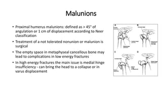 MANAGEMENT OF NONUNIONS AND MALUNIONS OF PROXIMAL HUMERAL FRACTURES.pptx