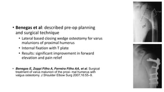MANAGEMENT OF NONUNIONS AND MALUNIONS OF PROXIMAL HUMERAL FRACTURES.pptx