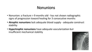 MANAGEMENT OF NONUNIONS AND MALUNIONS OF PROXIMAL HUMERAL FRACTURES.pptx