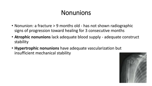 MANAGEMENT OF NONUNIONS AND MALUNIONS OF PROXIMAL HUMERAL FRACTURES.pptx