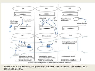 Management of no reflow | PPTX