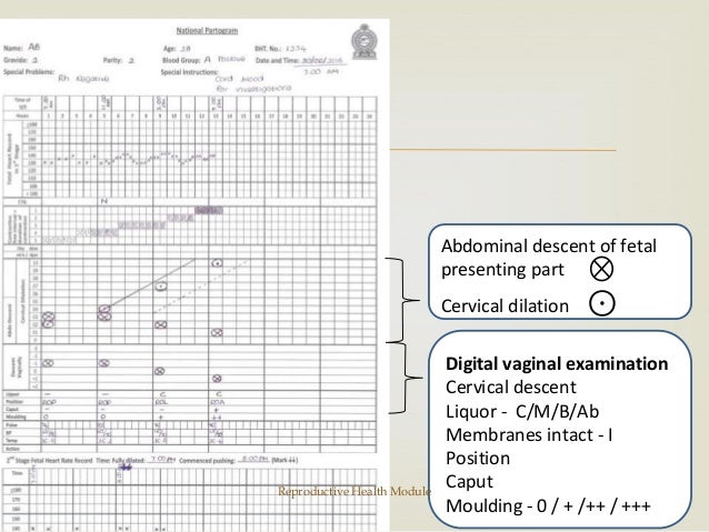 Management of normal labour and partogram