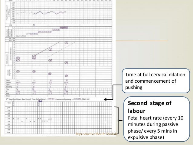 Management of normal labour and partogram