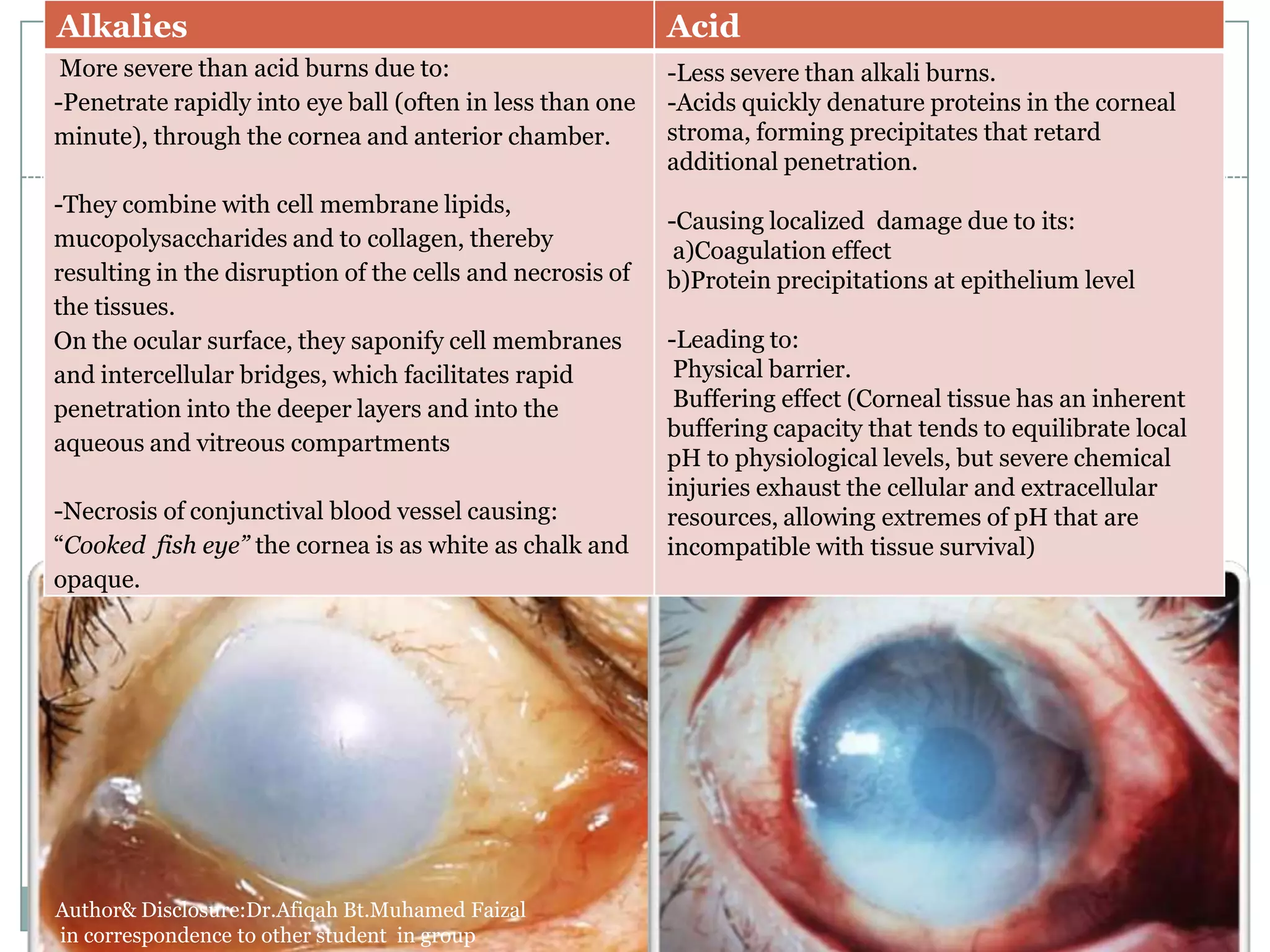 Management of ocular chemical injuries | PPTX