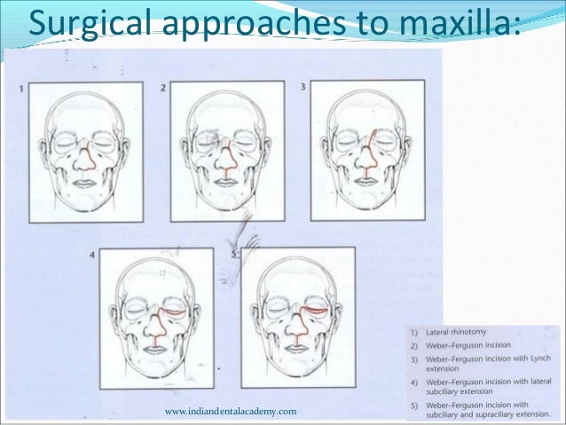 Management Of Odontogenic Tumors Certified Fixed Orthodontic Courses…