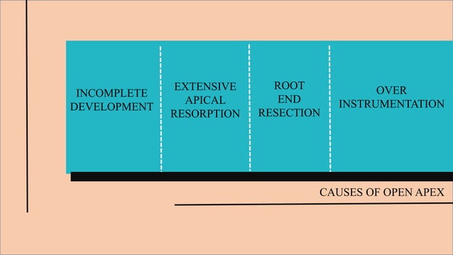 Management of open apex | PPT
