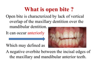 Management of open bite in orthodontics... | PPTX