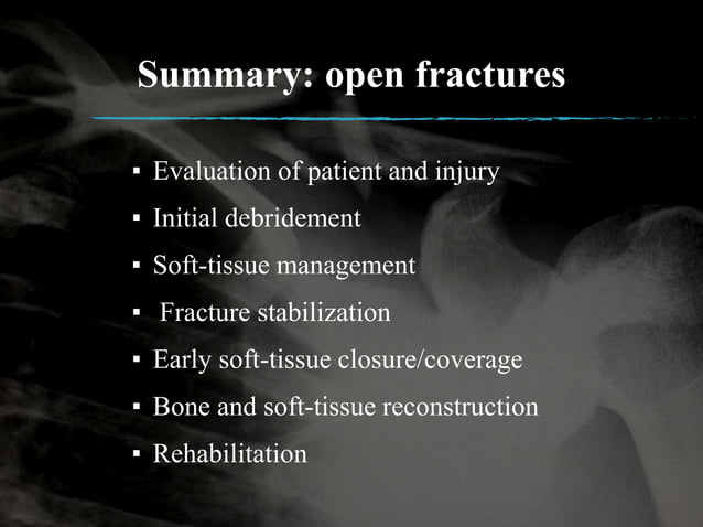 Management of open fracture true ppt | PPTX