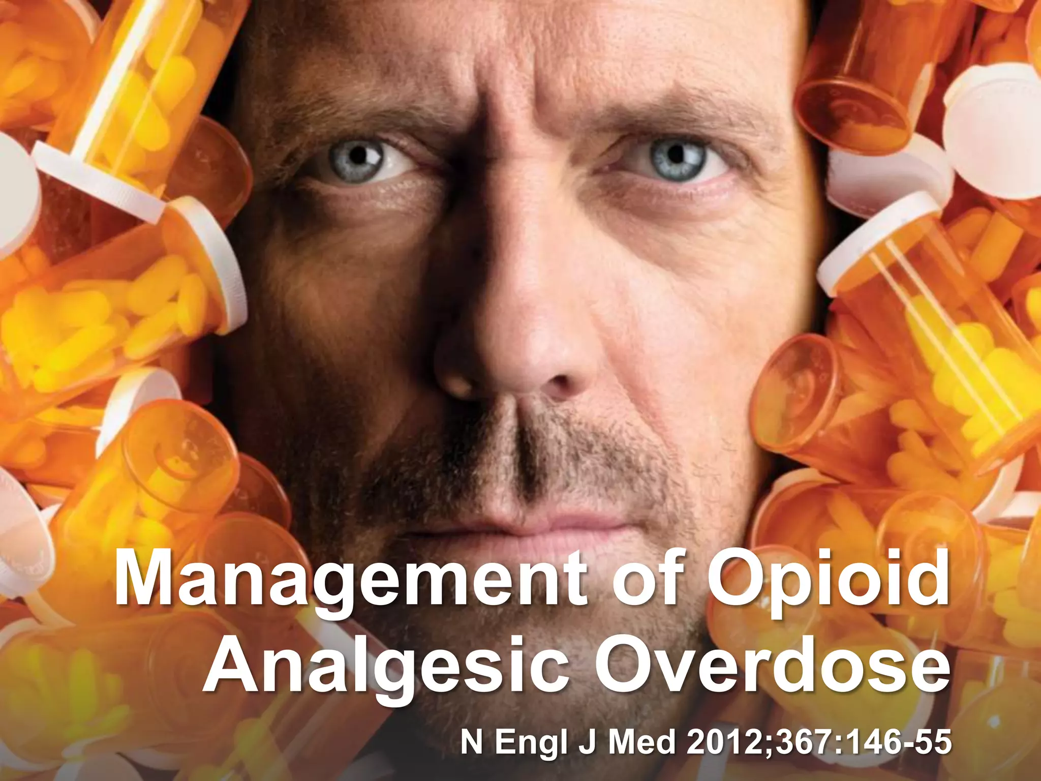 Management of Opioid Analgesic Overdose | PPTX
