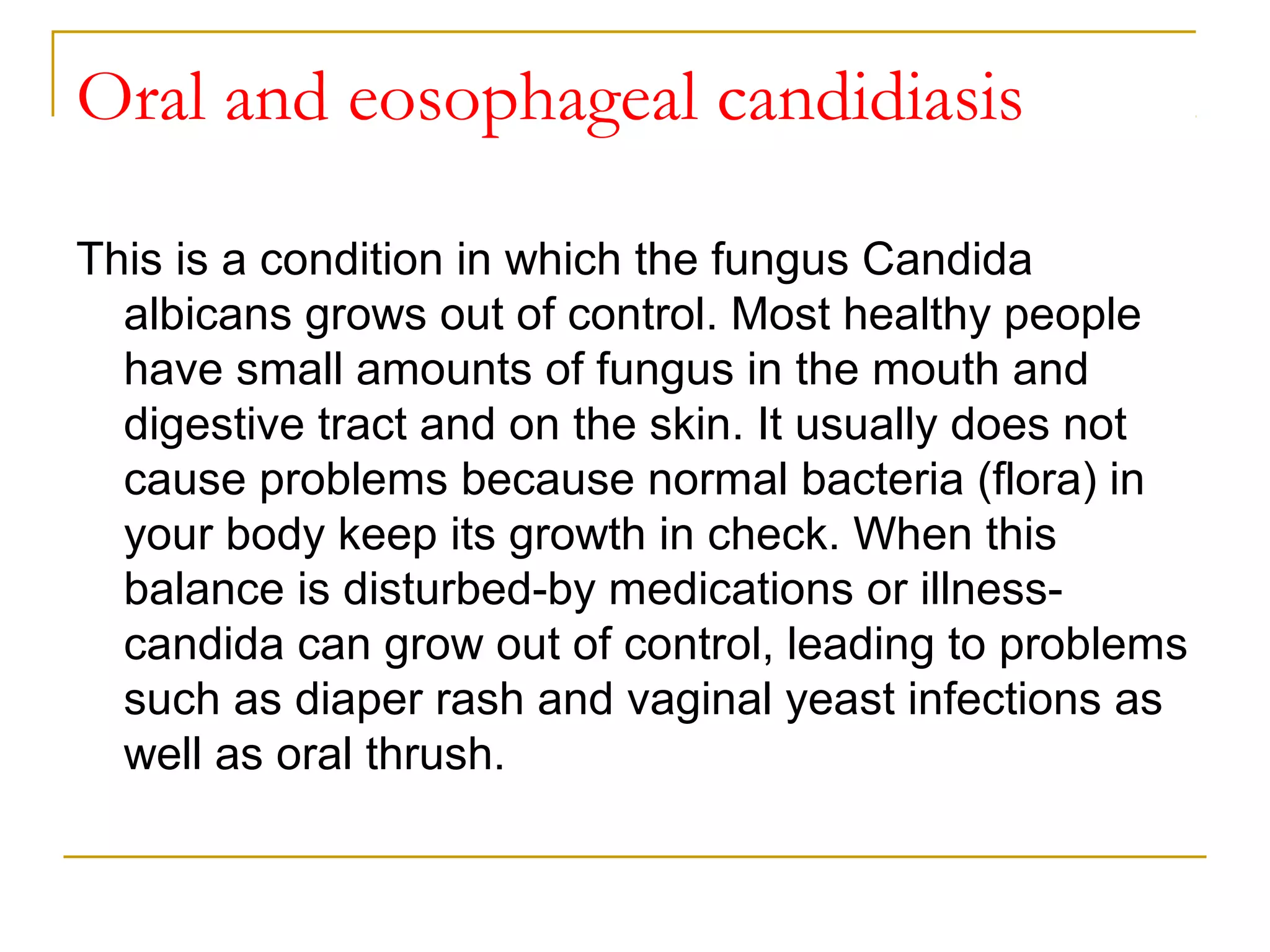 Management of opportunistic infections (o is) | PPT