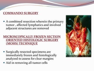 Management of Oral Cancer | PPTX