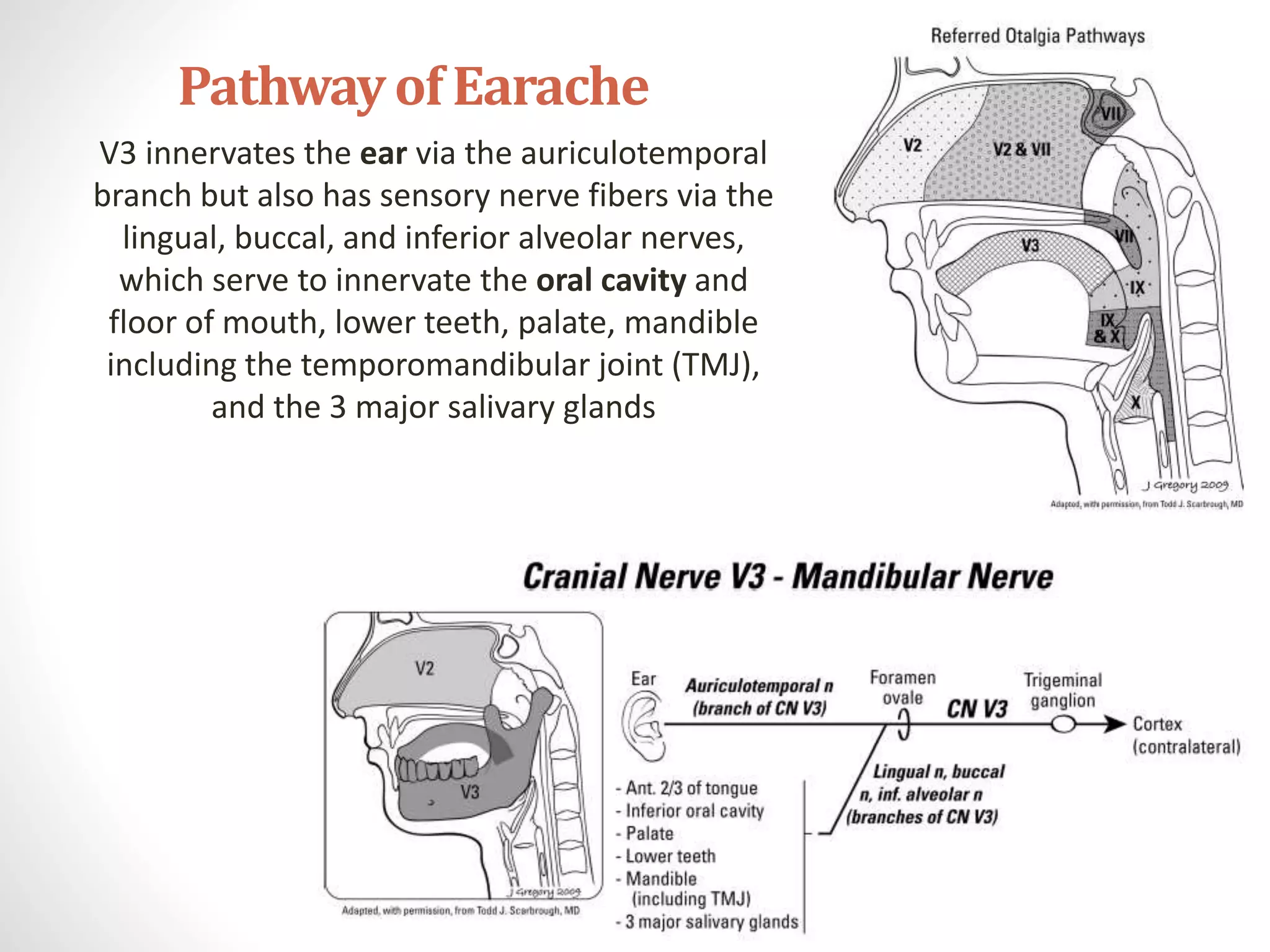 Management of oral cavity cancer 23072018 | PPTX