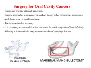Management of Oral Cavity Cancers | PPTX