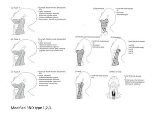Management of Oral Cavity Cancers | PPTX