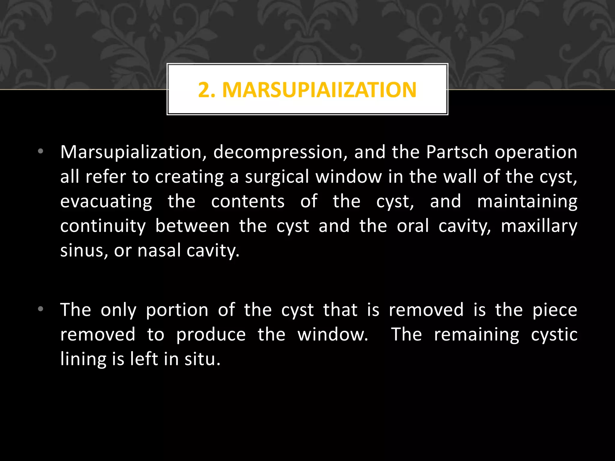 Management of oral cyst | PPTX