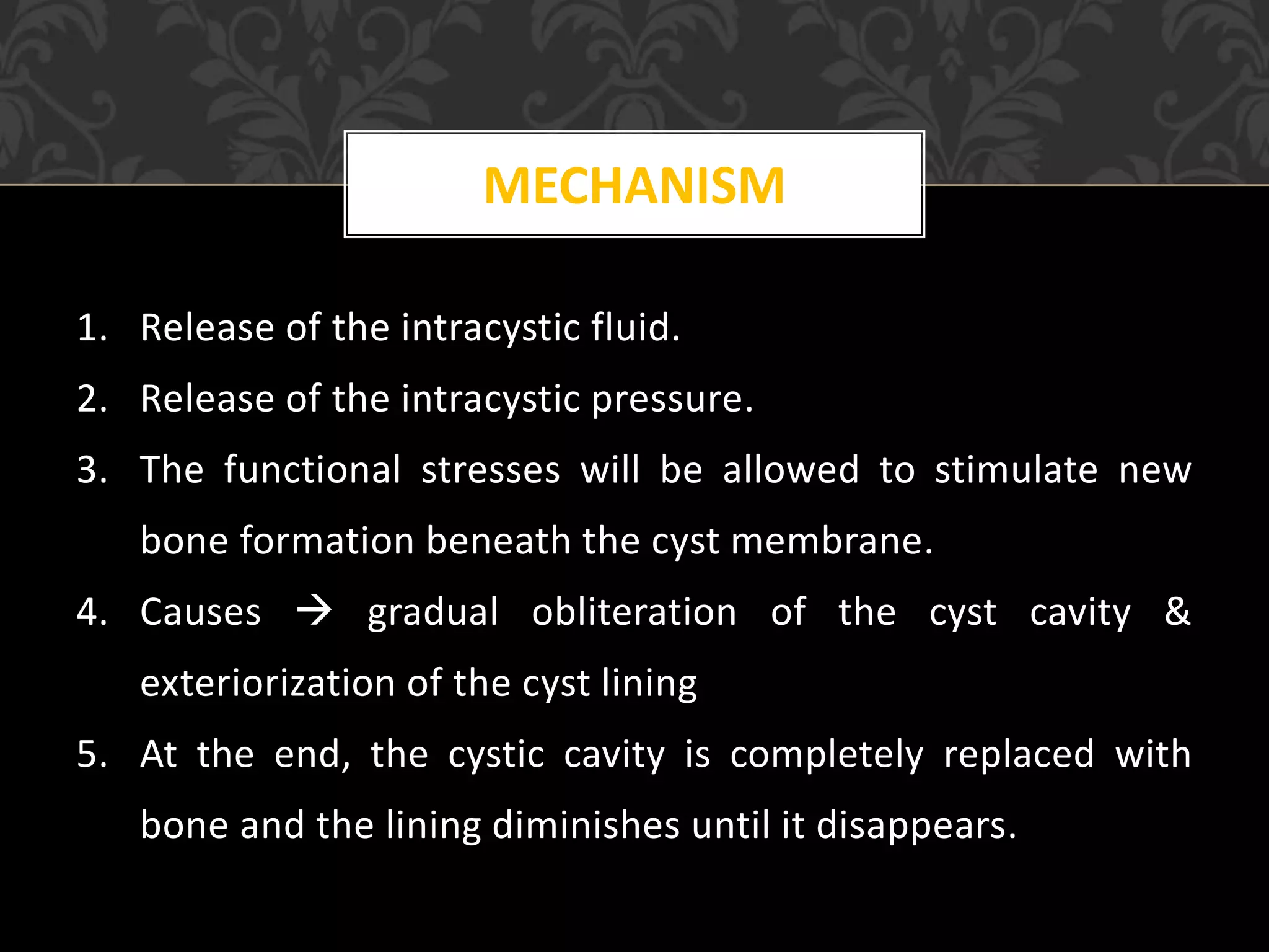 Management of oral cyst | PPTX