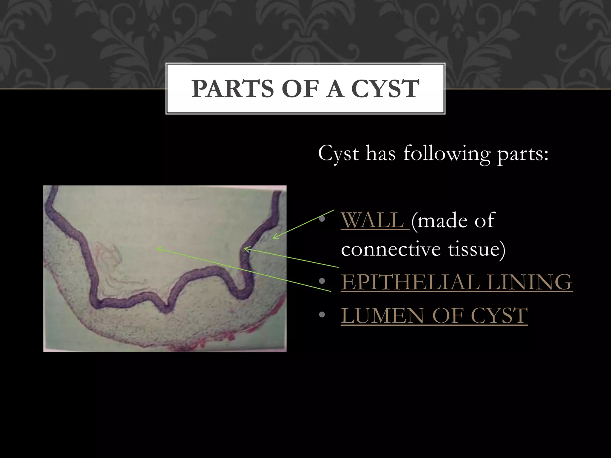 Management of oral cyst | PPTX