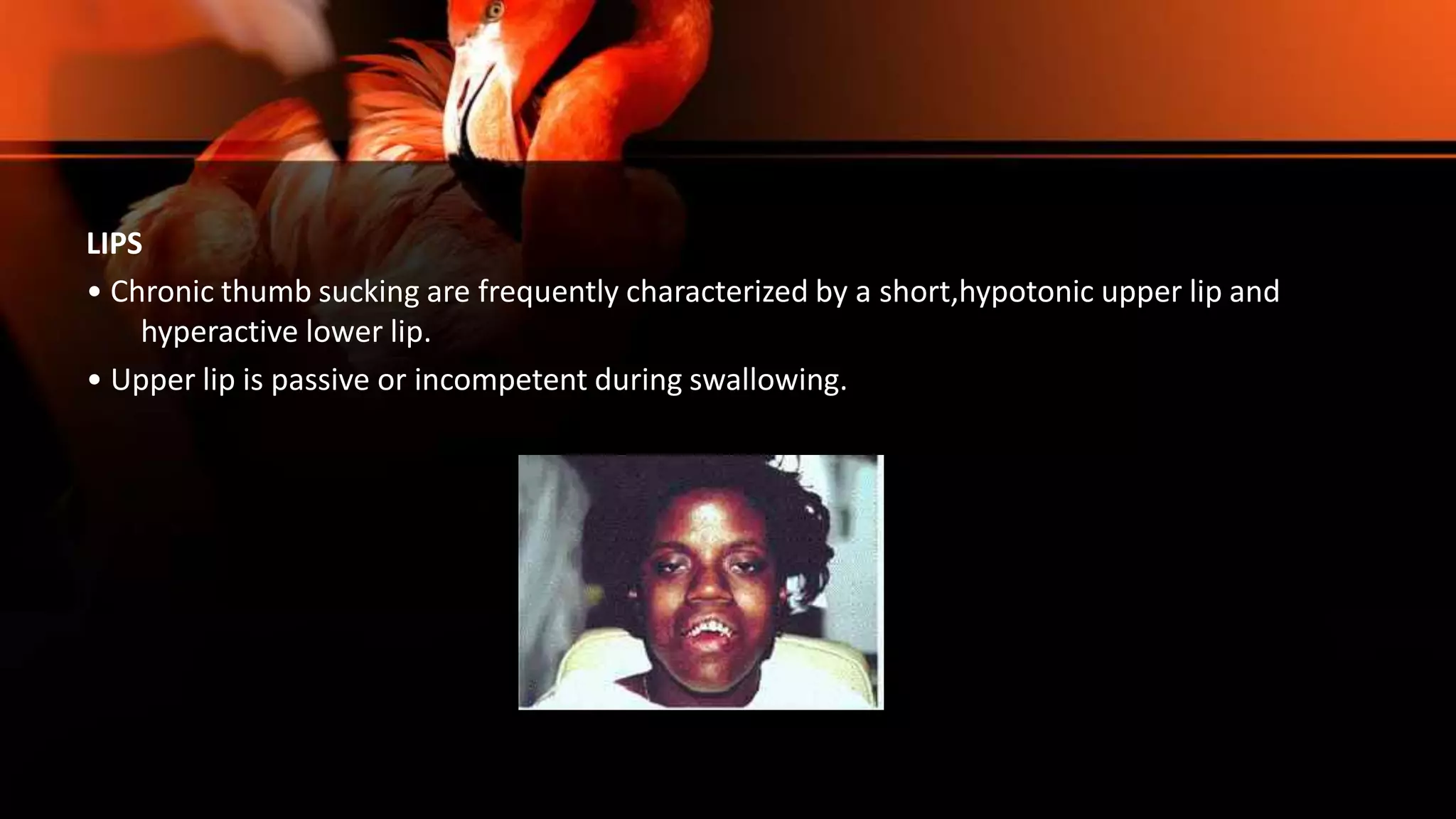 ORAL HABITS - DEFINITION, CLASSIFICATIONS, CLINICAL FEATURES AND ...