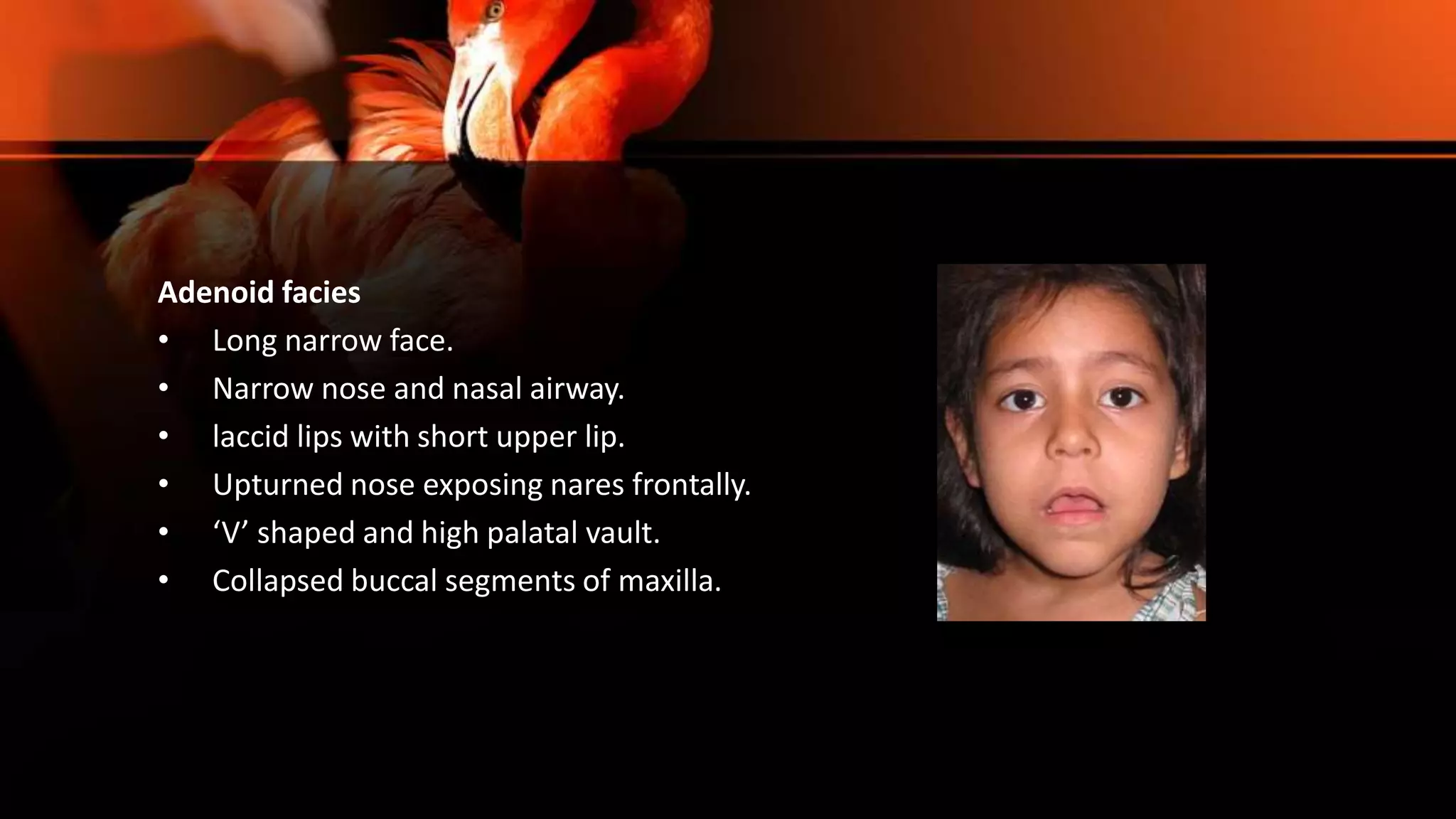 ORAL HABITS - DEFINITION, CLASSIFICATIONS, CLINICAL FEATURES AND ...