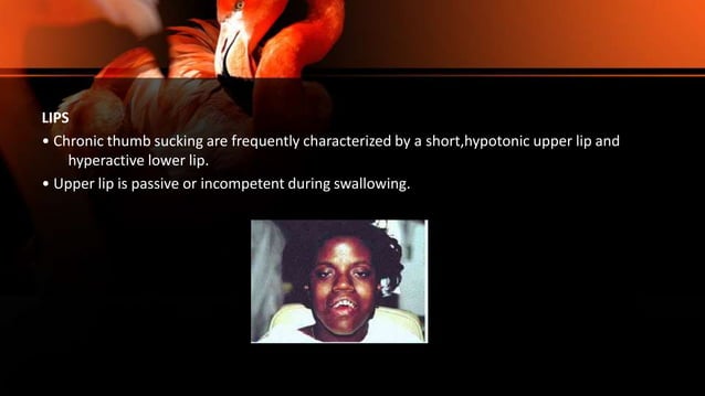 ORAL HABITS - DEFINITION, CLASSIFICATIONS, CLINICAL FEATURES AND ...