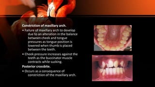 ORAL HABITS - DEFINITION, CLASSIFICATIONS, CLINICAL FEATURES AND ...
