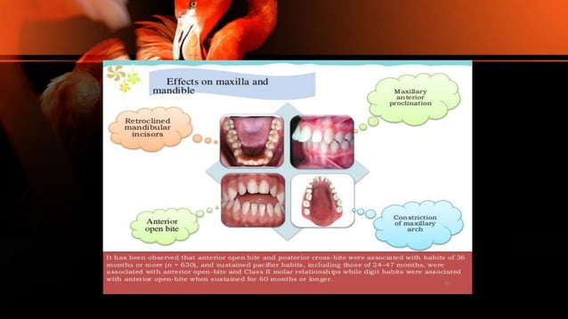 ORAL HABITS - DEFINITION, CLASSIFICATIONS, CLINICAL FEATURES AND ...