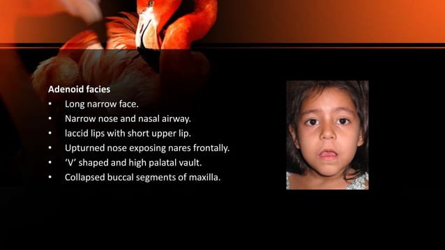 ORAL HABITS - DEFINITION, CLASSIFICATIONS, CLINICAL FEATURES AND ...