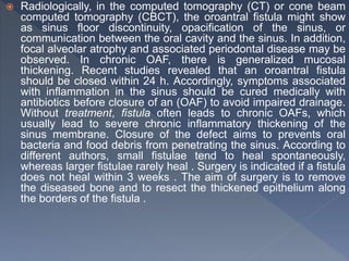 Management of oro antral fistula | PPTX