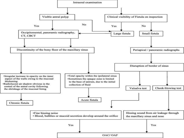 Management of oro antral fistula | PPTX | Ear, Nose and Throat ...