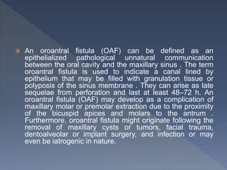 Management of oro antral fistula | PPT