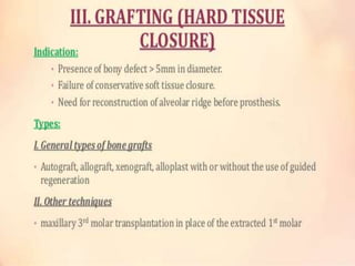 Management of oro antral fistula