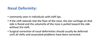 management of orofacial clefts.pptx