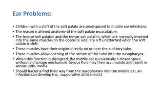 management of orofacial clefts.pptx