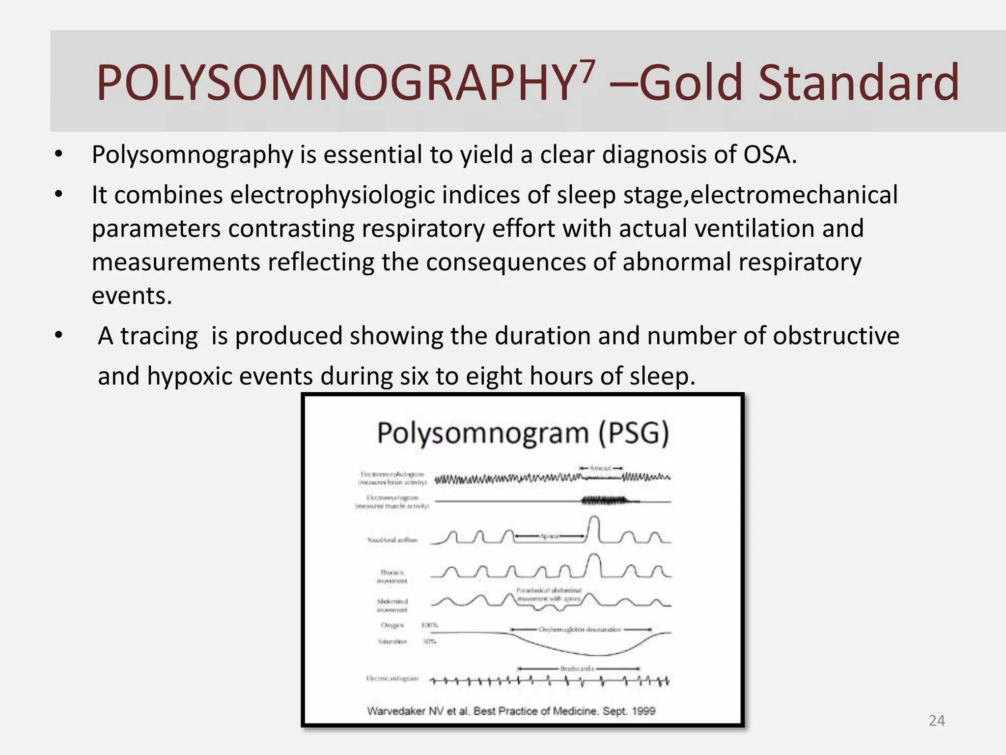 Management of obstructive sleep apnea | PPTX