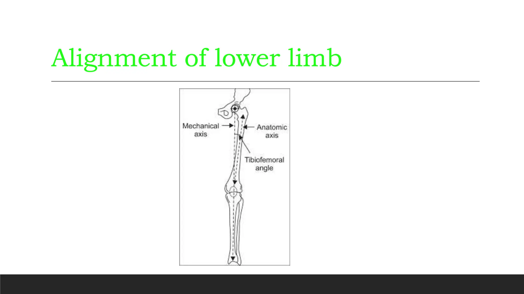 Management of Osteoarthritis of knee by High tibial.pptx