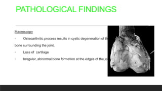Management of Osteoarthritis of knee by High tibial.pptx
