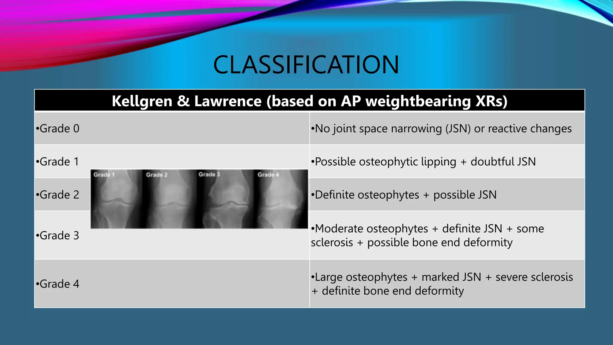 Management of Osteoarthritis of the Knee last.pptx