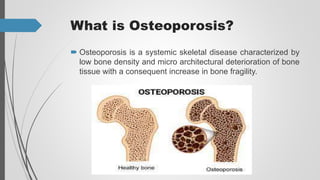 Management of Osteoporosis.pptx