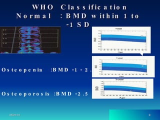 Management of osteoporosis final | PPT