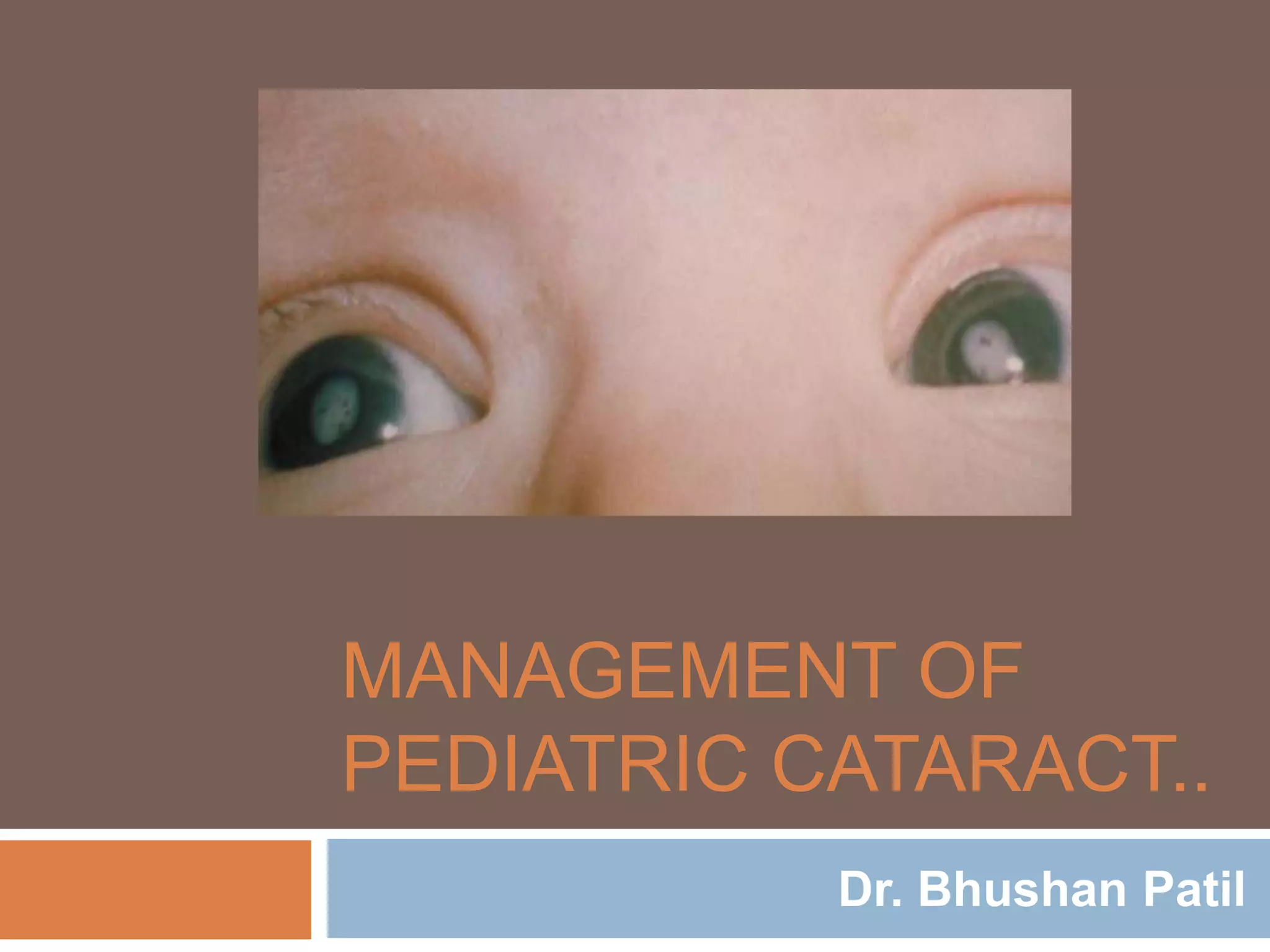 Management of paediatric cataract DrBP | PPTX