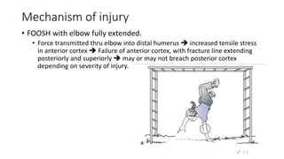 Management of paediatric supracondlar humeral fractures | PPT