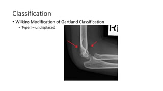 Management of paediatric supracondlar humeral fractures | PPT