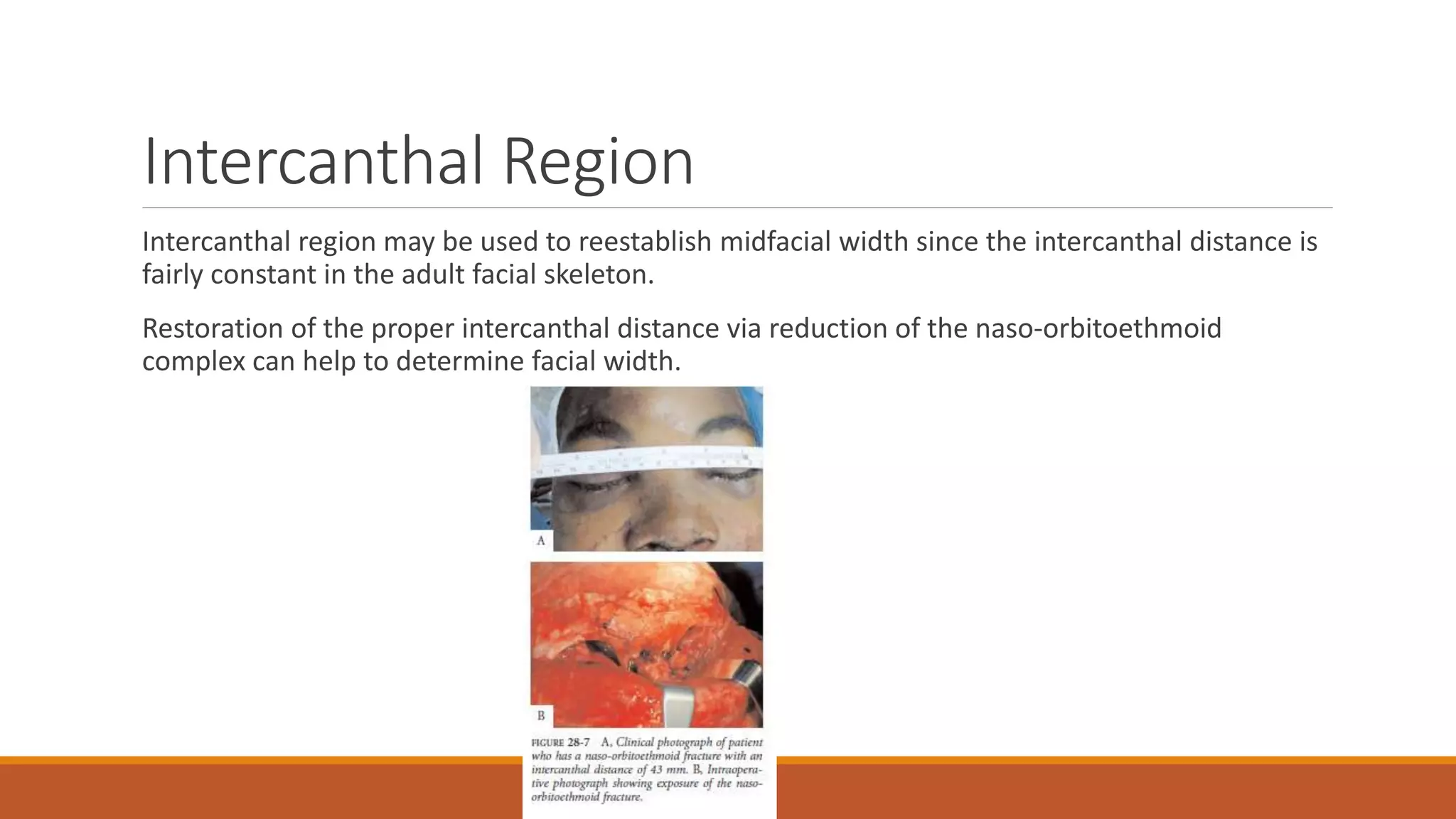 Management of Panfacial Fractures(1).pptx