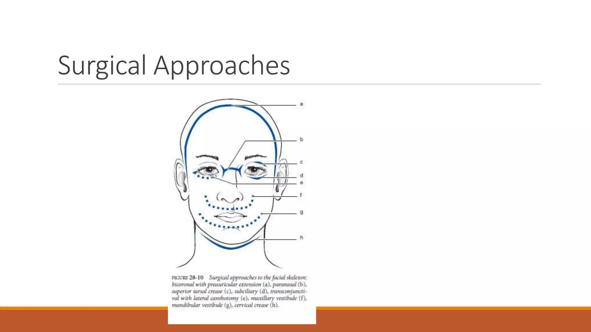 Management of Panfacial Fractures(1).pptx