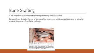 Management of Panfacial Fractures(1).pptx