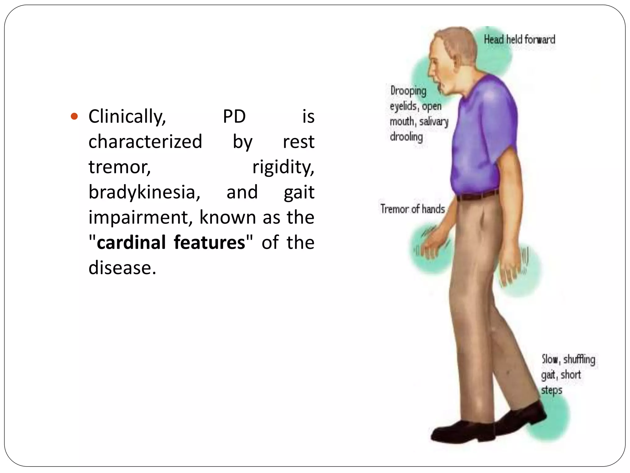 Management of parkinsons disease | PPTX