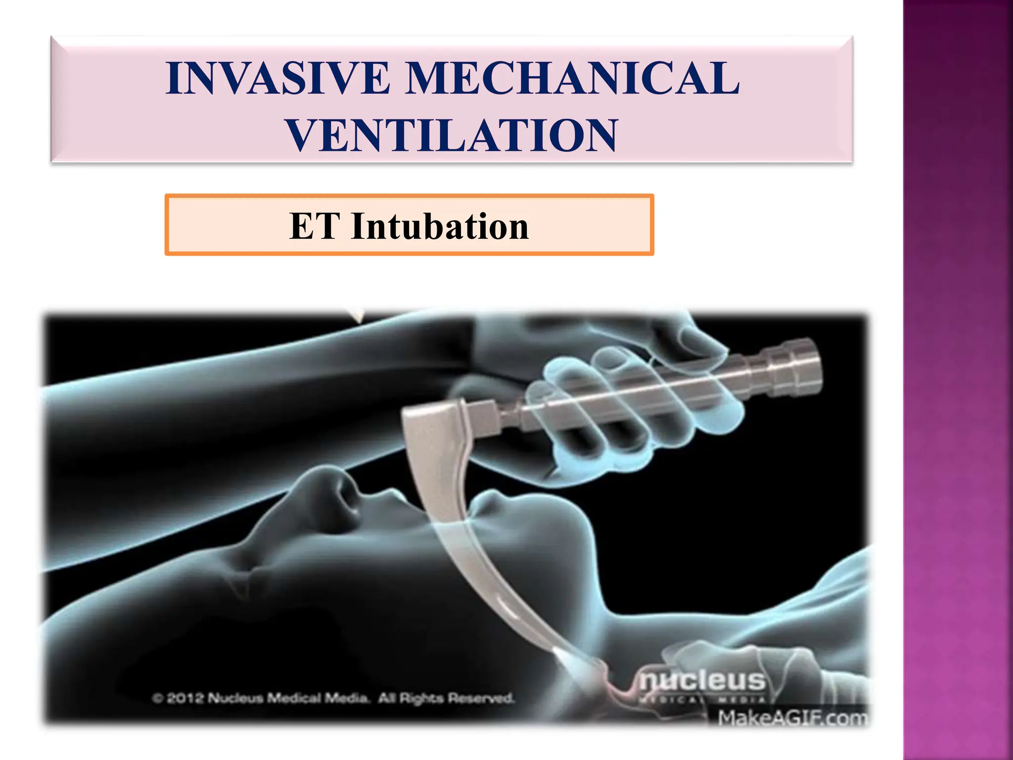 MANAGEMENT OF PATIENT IN MECHANICAL VENTILATOR .pptx