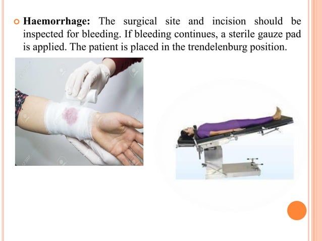 Management Of Patient Undergoing Surgery | PDF